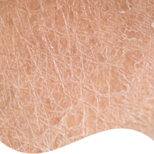 Genodermatoses: Congenital skin disorders - Subi Derm