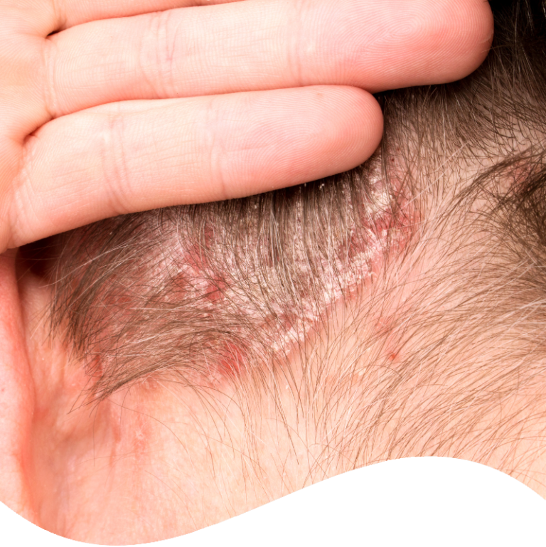 Hair and nail conditions Perth | Treatments - Subi Derm